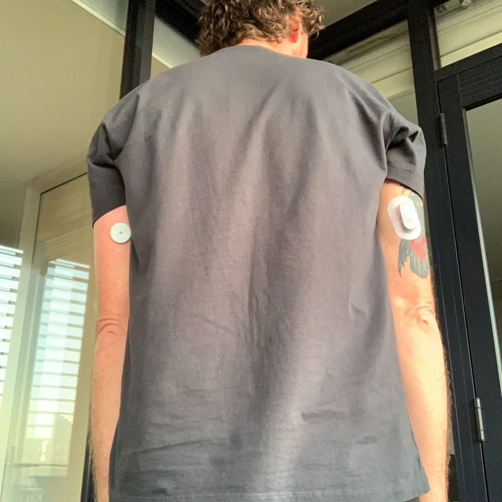 Dexcom G6 vs Freestyle Libre [My Personal Experience]