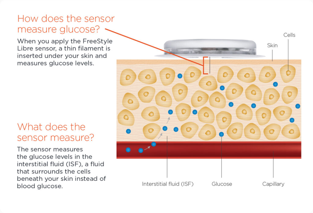 How does Freestyle Libre Work: Amazing Features Explained