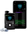 Dexcom vs Medtronic - Which is The Best CGM for You?