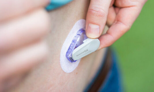 Dexcom vs Medtronic - Which is The Best CGM for You?
