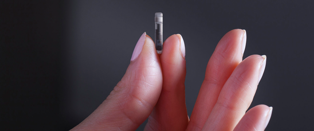 All about the Eversense CGM system | Not Just a Patch