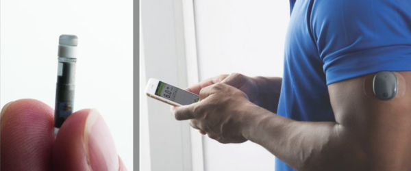 All about the Eversense CGM system | Not Just a Patch